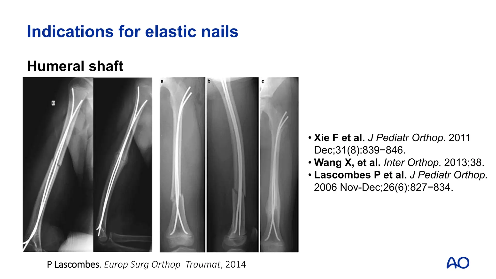 AO Trauma Pediatrics - Elastic nailing - M Kremli 2022.pptx