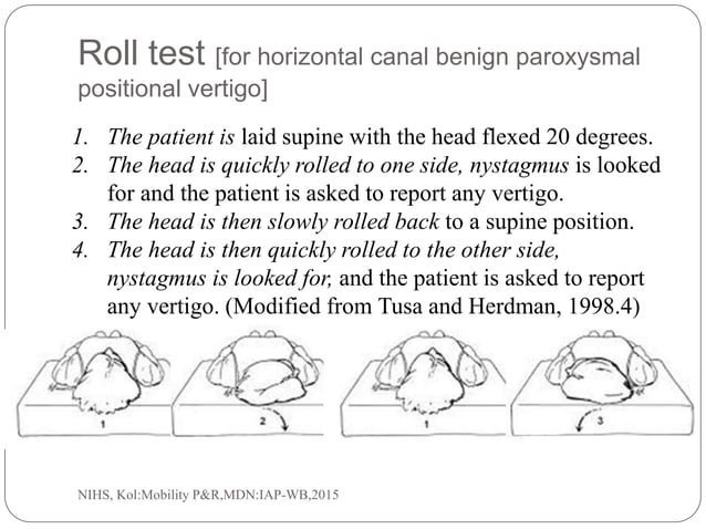 BPPV - Physical Diagnosis and Management | PPT
