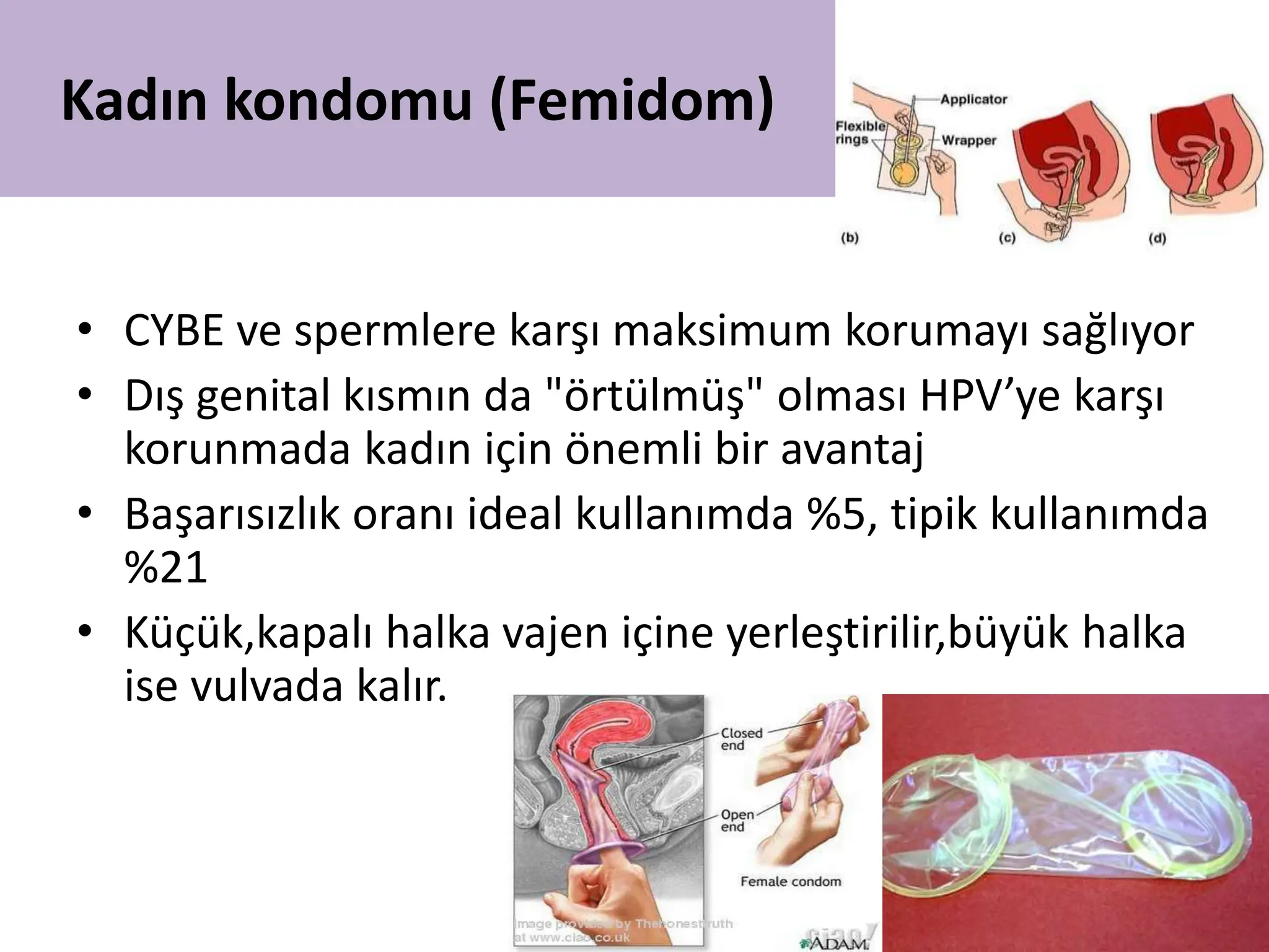 1. basamakta kontrasepsiyona yaklaşım.pptx