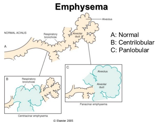 Ap 50 10-29 1 pathology of lung 1