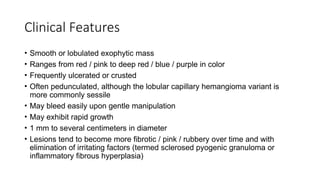 Apa itu pyogenic granuloma dan ciri cirinya | PPT