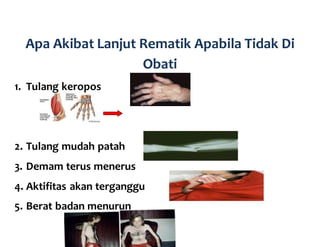 Apa itu rematik | DOC
