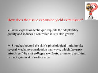 Tissue Expanders in OMFS | PPTX