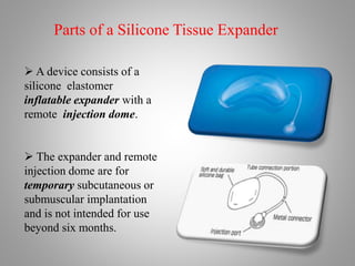 Tissue Expanders in OMFS | PPTX