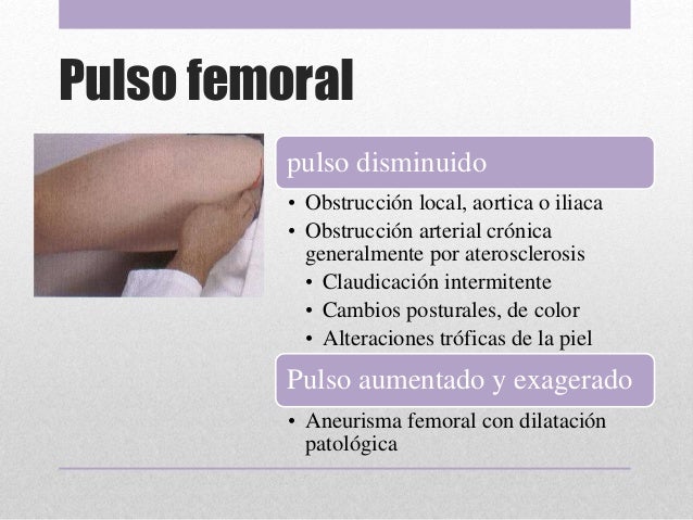 Aparato circulatorio