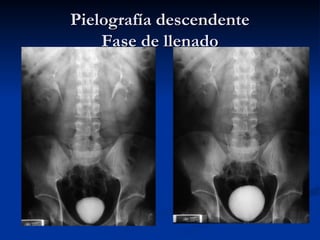 diagnostico por imagenes del aparato genito urinario | PPT