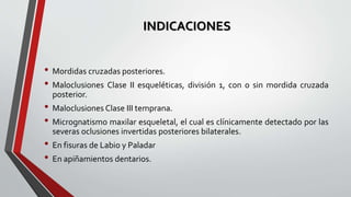 Aparatología fija | PPTX
