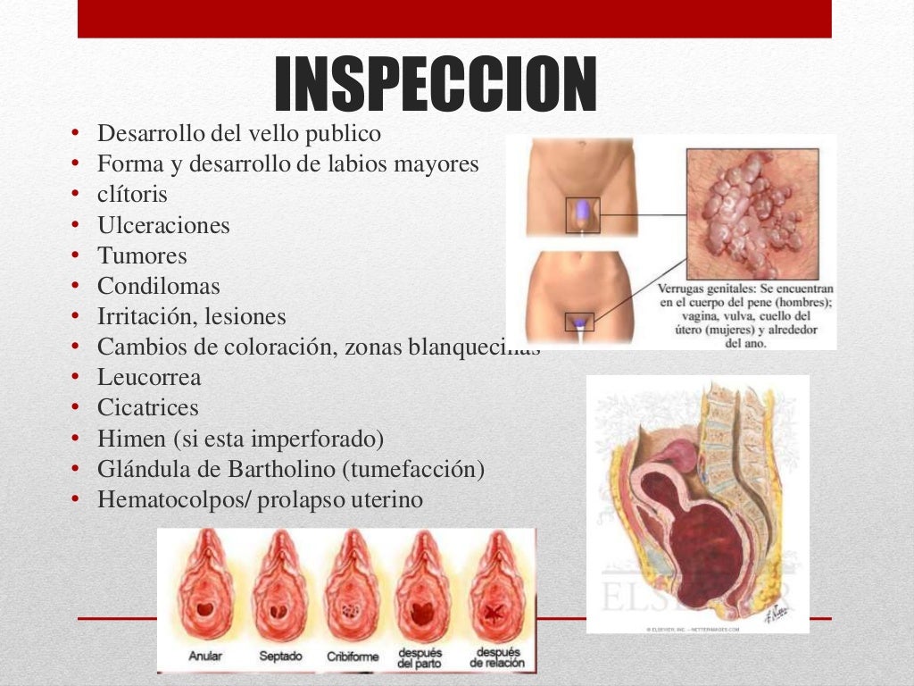 Examen Fisico Aparato Reproductor Feminino