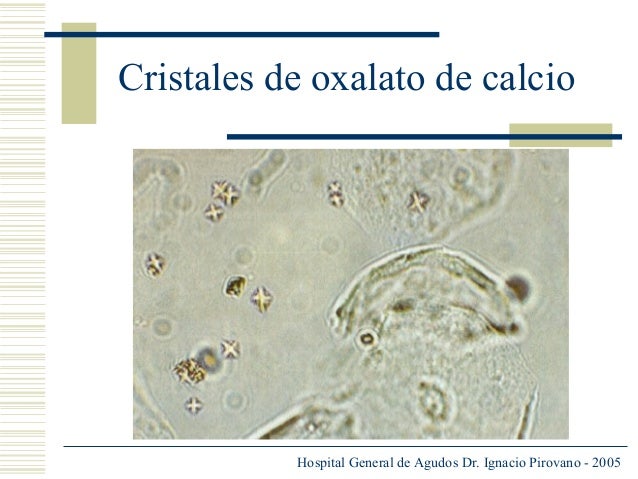 INTOXICACIÓN POR OXALATOS SOLUBLES: DIAGNOSTICO