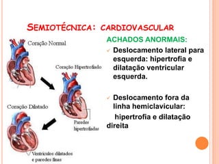 Exame físico cardiovascular- uso de técnicas propedêuticas | PDF