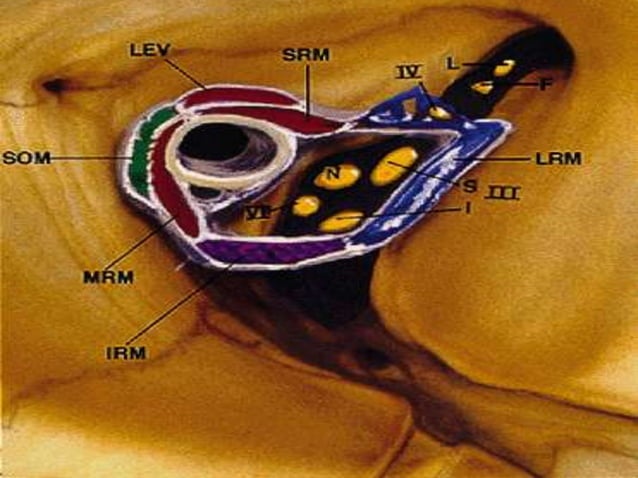 A-V pattern strabismus | PPTX | Eye and Vision Conditions | Diseases ...