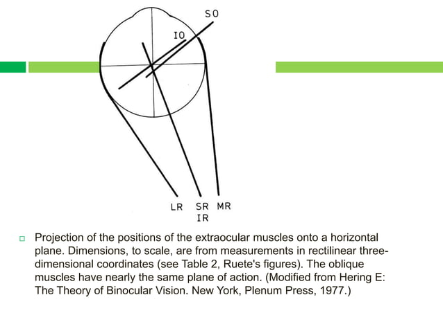 A-V pattern strabismus | PPTX | Eye and Vision Conditions | Diseases ...