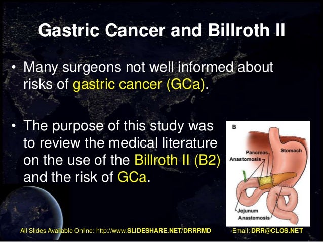 Gastric Bypass Billroth I Versus Billroth Ii Anatomy