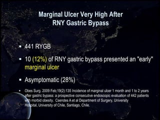 Apc a-00025-bile reflux gastritis and marginal ulcer | PPT