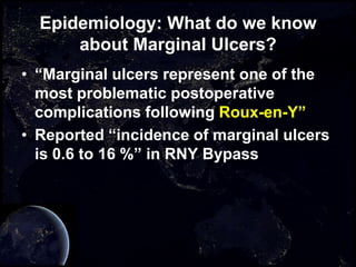 Apc a-00025-bile reflux gastritis and marginal ulcer | PPT