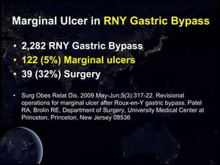 Apc a-00025-bile reflux gastritis and marginal ulcer | PPT