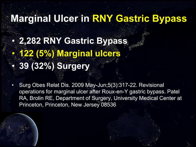 Apc a-00025-bile reflux gastritis and marginal ulcer | PPT