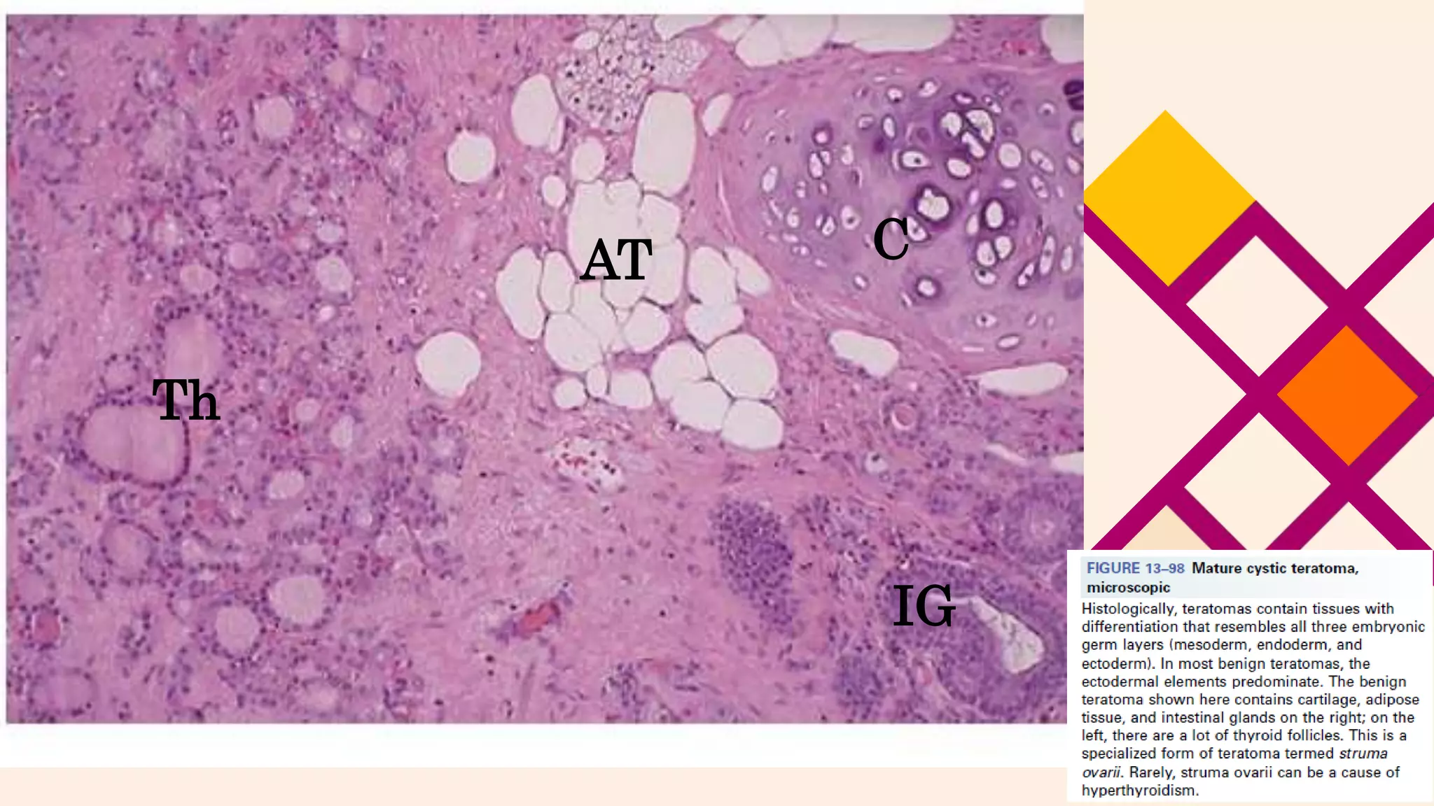 Anatomic Pathology Case Report | PPT