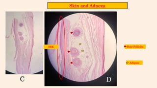 Anatomic Pathology Case Report | PPT