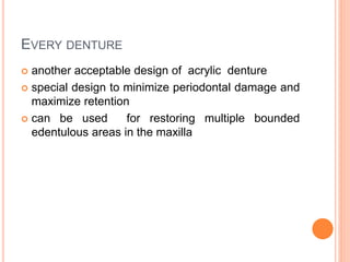 Acrylic partial denture | PPTX
