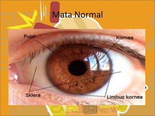 APD kebun yang harus dilakukan dan wajib | PDF