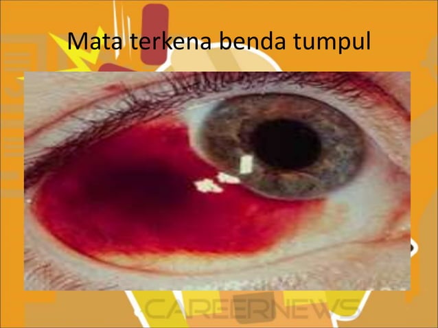 APD kebun yang harus dilakukan dan wajib | PDF