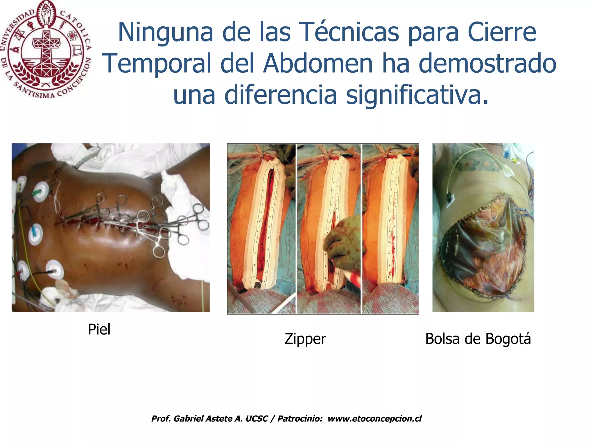 cirugia de control de daños en Abdomen ucsc | PDF | Injuries | Diseases ...