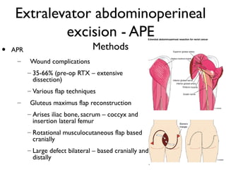 Extralevator abdominoperineal excision | PPT