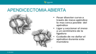 Apendicectomia abierta.pdf