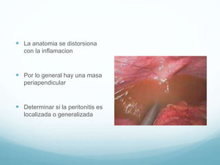 Apendicectomia laparoscopia | PPTX