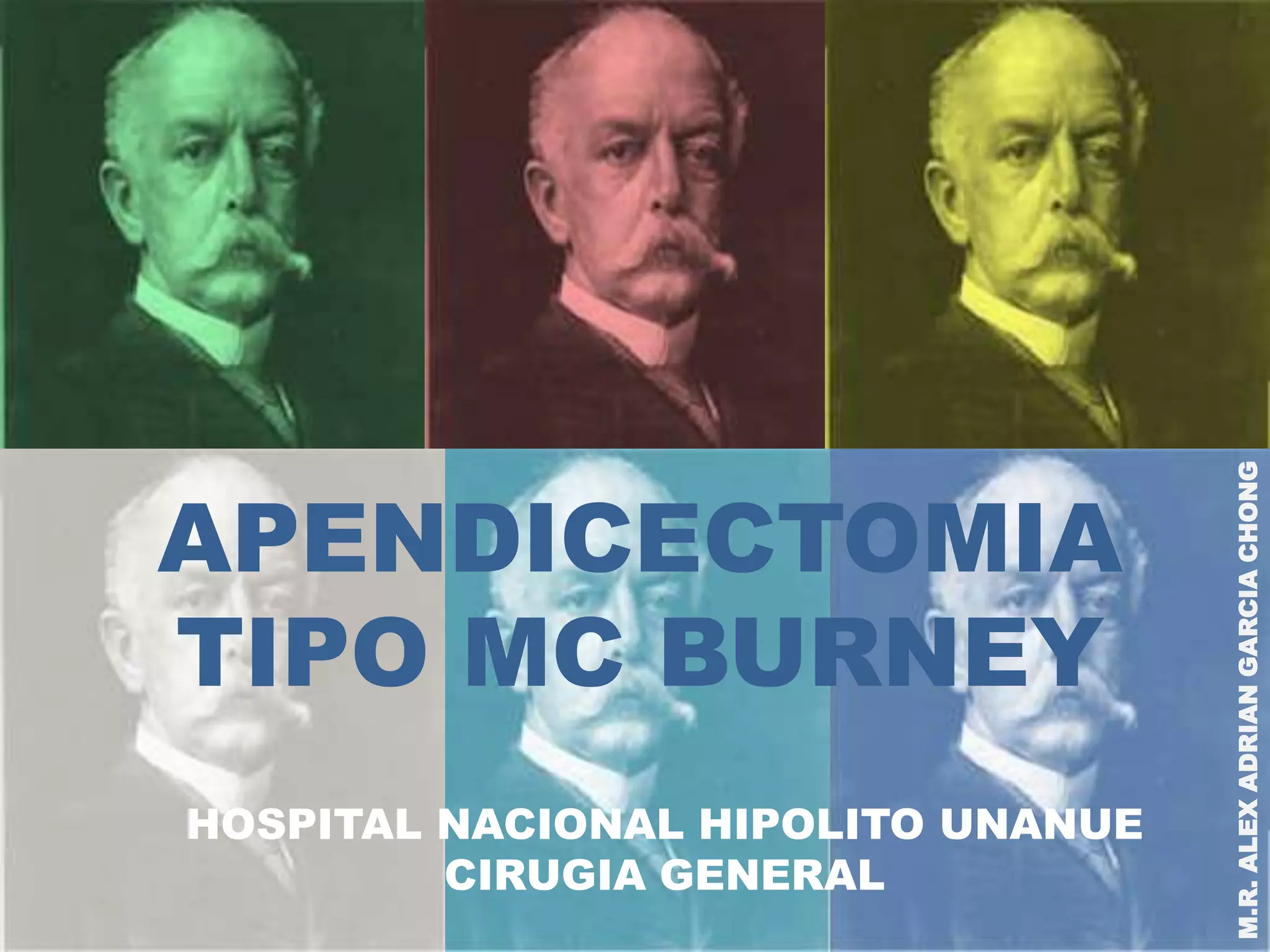 Apendicectomia Tipo Mc Burney | PPTX
