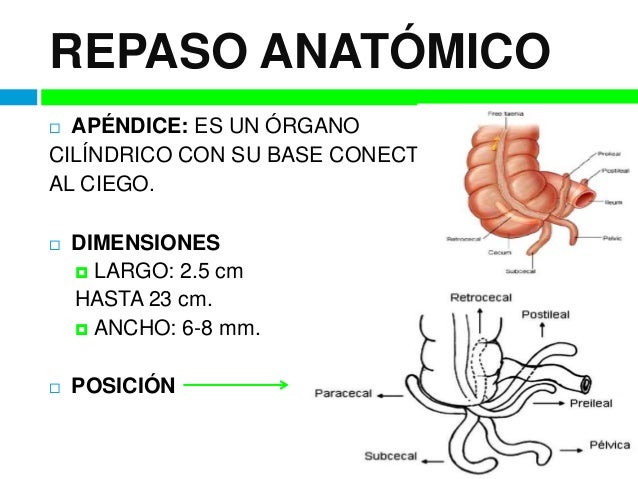 Apendicistis láminas romner rodriguez (2)