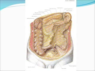 Apendicitis | PPT