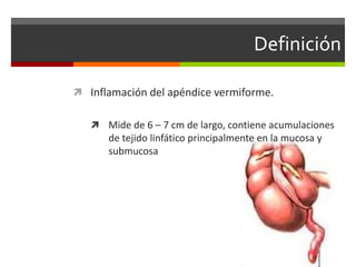 Apendicitis | PPTX
