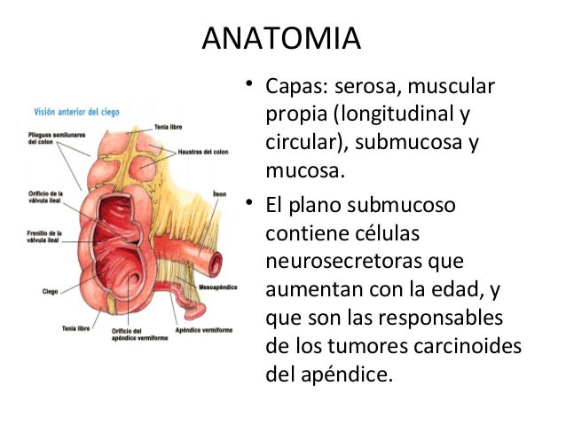 Apendicitis