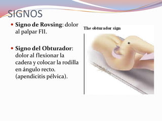 Apendicitis | PPTX