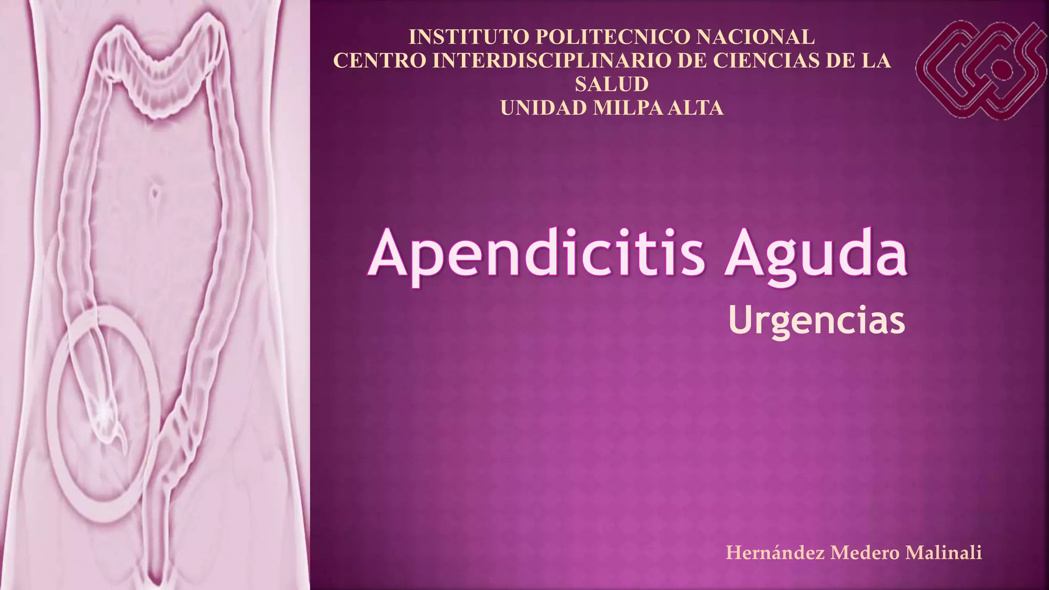 Apendicitis, Apendice | PPT