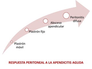 Apendicitis aguda | PPTX