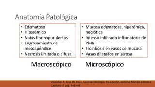 Apendicitis | PPTX