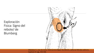 Apendicitis | PPTX