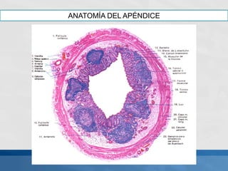 Apendicitis Aguda | PPTX