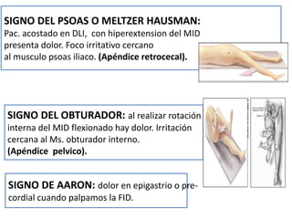 Apendicitis - cirugía | PPT