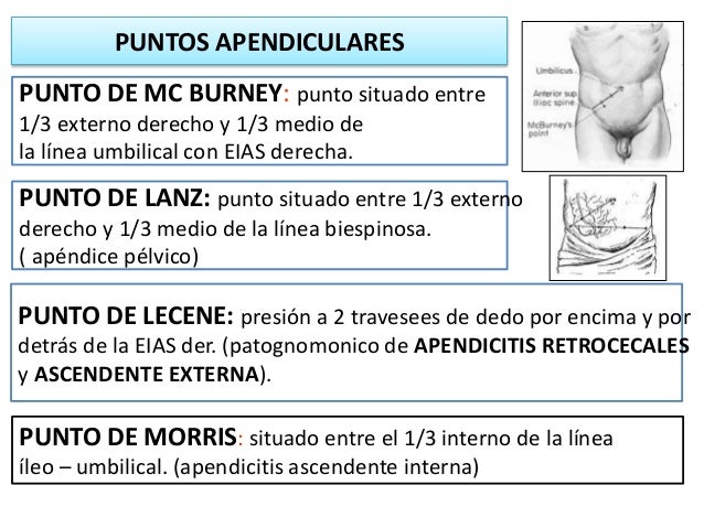 Apendicitis - cirugía