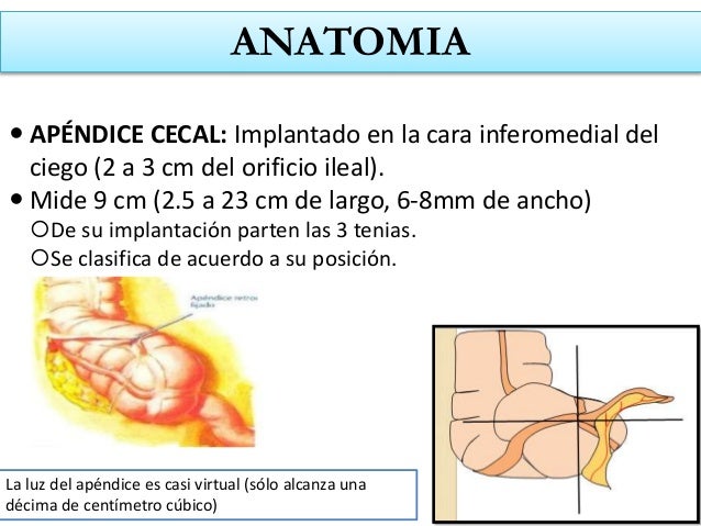 Apendicitis - cirugía
