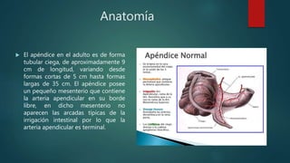 Apendicitis | PPTX