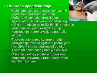 Apendicitis | PPT