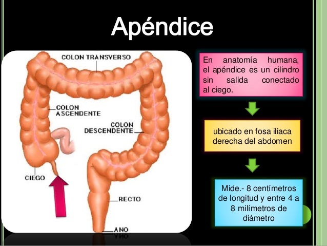Apendicitis