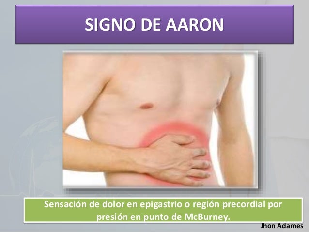 Apendicitis Aguda