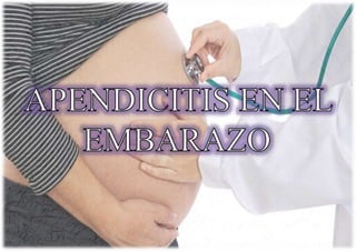 Apendicitis en el embarazo | PPTX