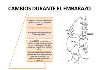 Apendicitis en el embarazo | PPTX